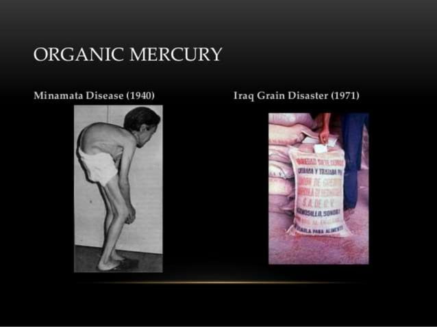 Mercury toxicity & hygiene | PPTX | Dental Health | Diseases and Conditions