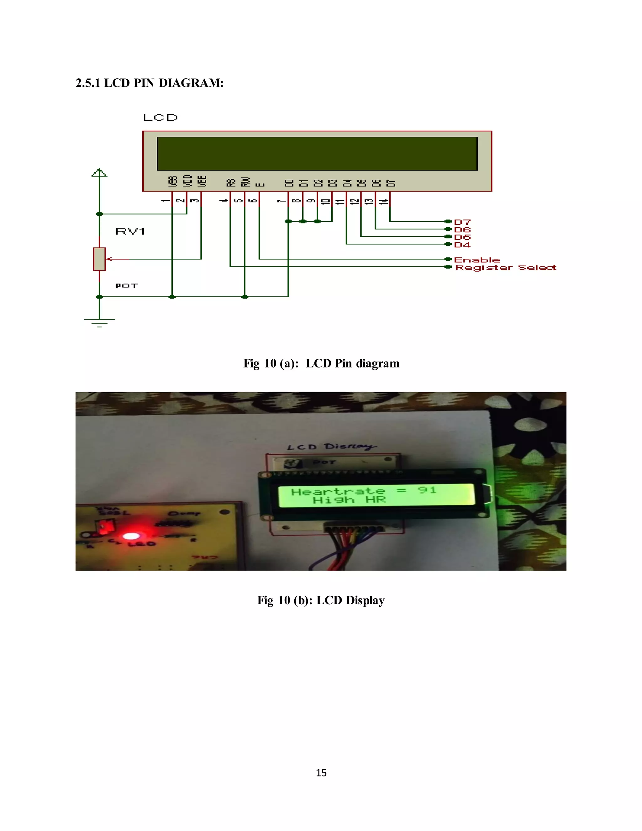 REAL TIME HEART BEAT MONITORING SYSTEM USING PIC16F876 MICROCONTROLLER | PDF