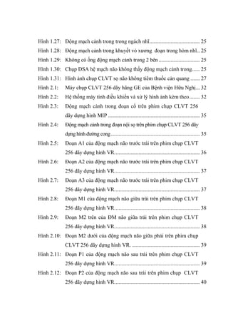 Luận án: Nghiên cứu giải phẫu các động mạch não trên hình ảnh chụp cắt ...