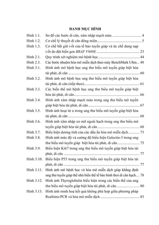 Luận án: Mô bệnh học, hóa mô miễn dịch, đột biến gen BRAF V600E trong ...