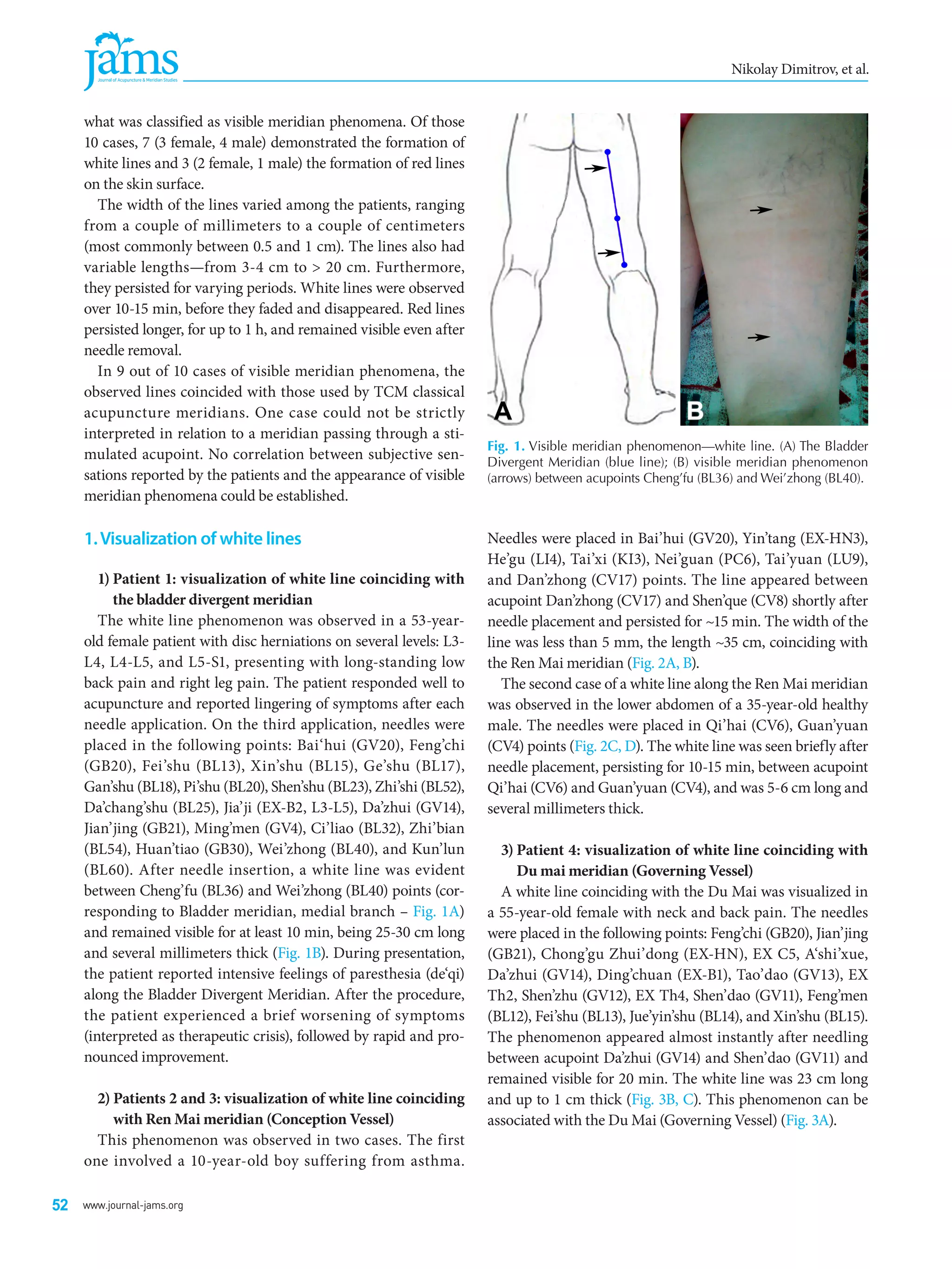 MERIDIANS ACUPUNCTURE 2021.pdf