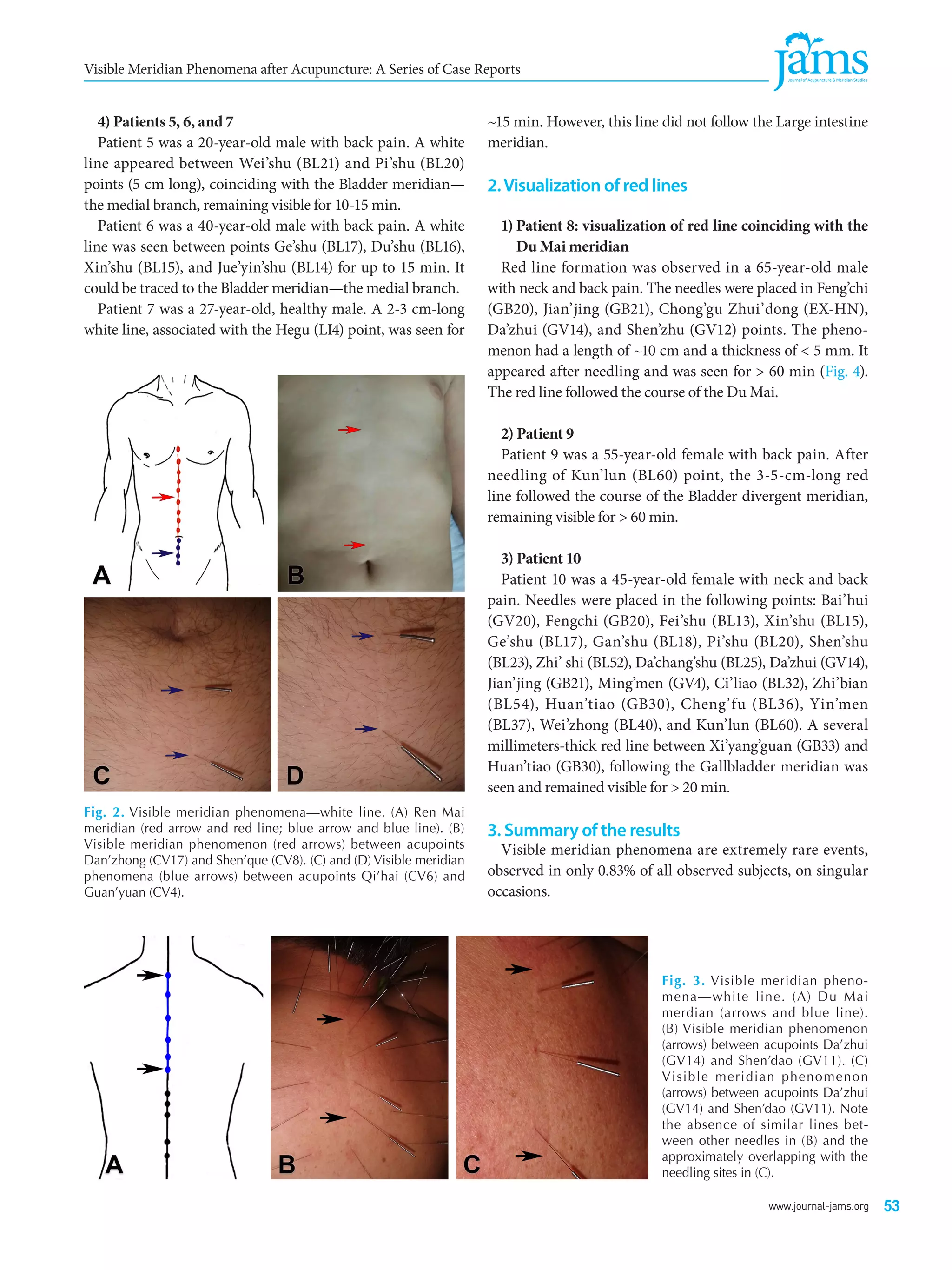 MERIDIANS ACUPUNCTURE 2021.pdf