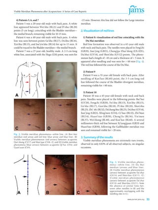 MERIDIANS ACUPUNCTURE 2021.pdf