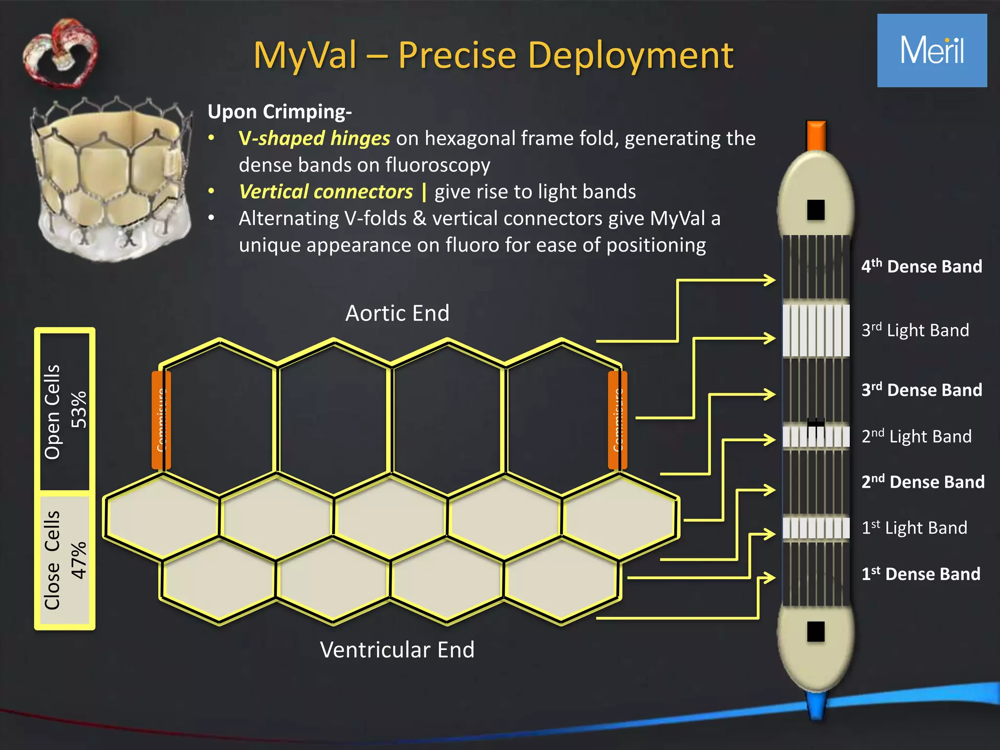 Meril - TAVI | PDF