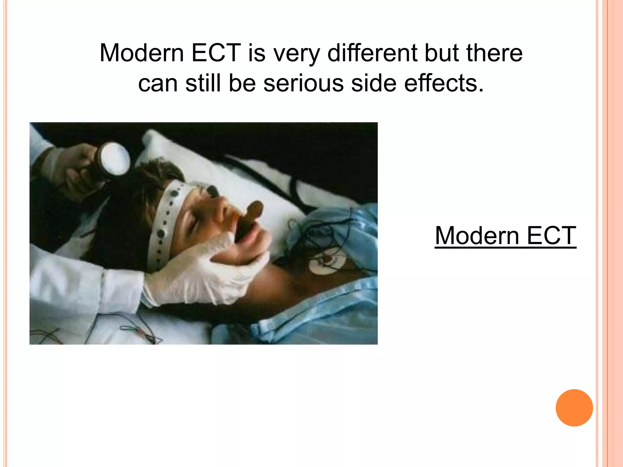 Electroconvulsive Therapy (ECT) | PPTX | Physical Therapy | Wellness