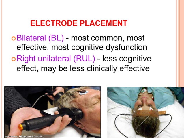 Electroconvulsive Therapy (ECT) | PPTX | Physical Therapy | Wellness