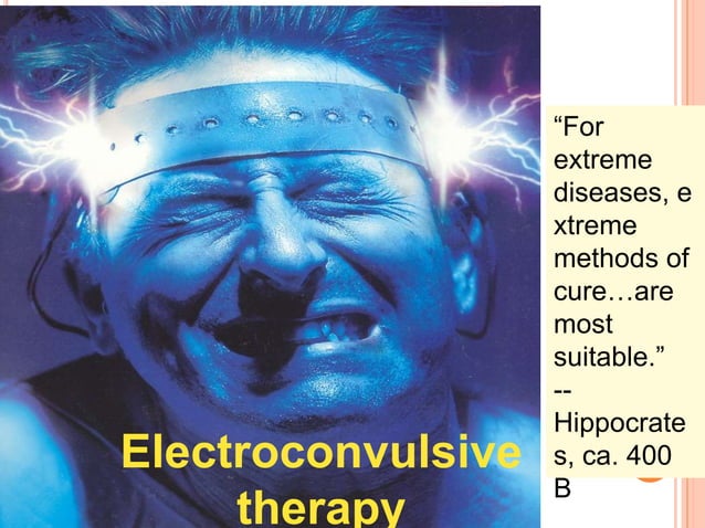Electroconvulsive Therapy (ECT) | PPTX | Physical Therapy | Wellness