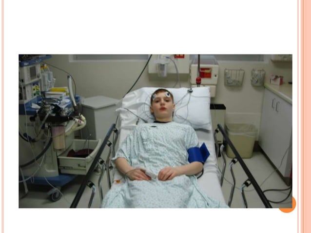 Electroconvulsive Therapy (ECT) | PPTX | Physical Therapy | Wellness