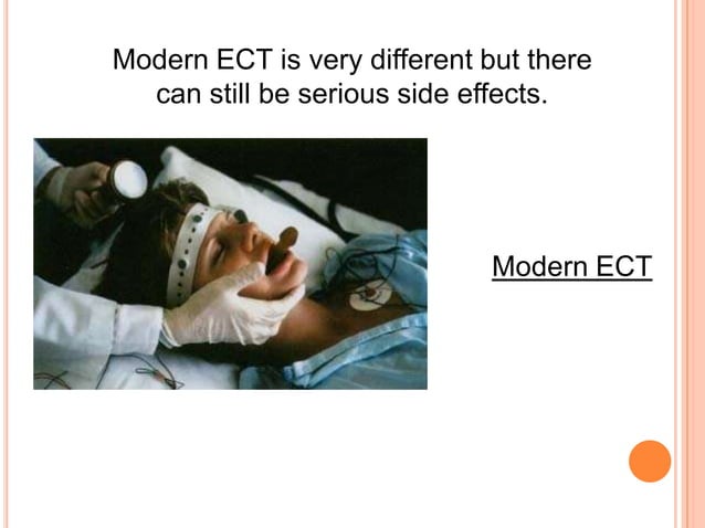 Electroconvulsive Therapy (ECT) | PPTX | Physical Therapy | Wellness