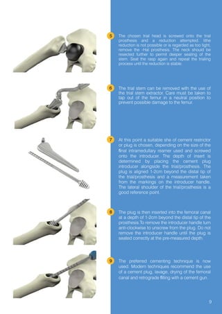 Learn about the MITSU™ POLYGLACTIN 910 Synthetic Absorbable Sutures at ...