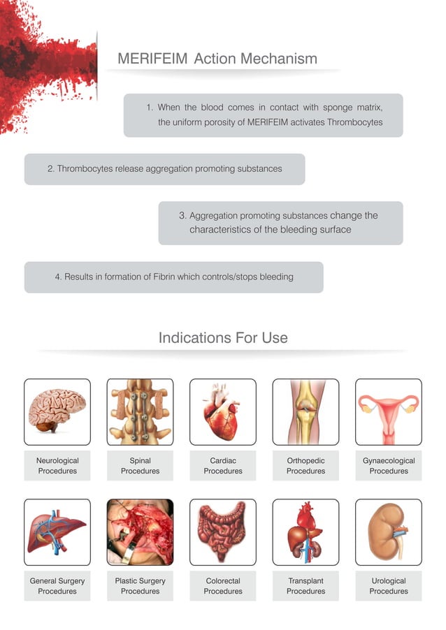 Merifeim: Gelatin Sponge Hemostat for Endo Surgery | PDF