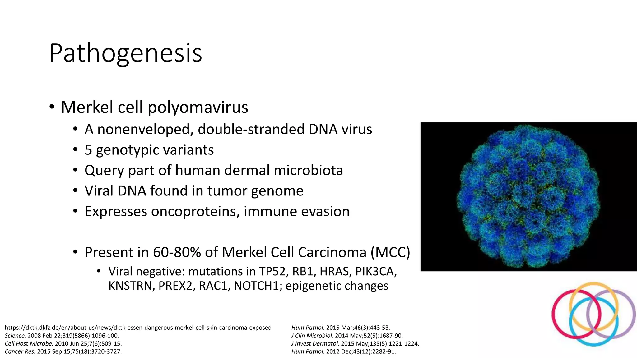 Merkel Cell Carcinoma: From Diagnosis to Treatment (webinar) | PPTX