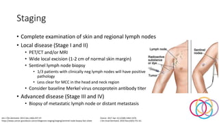Merkel Cell Carcinoma: From Diagnosis to Treatment (webinar) | PPTX