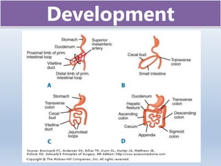 Merkel's diverticulum | PPTX