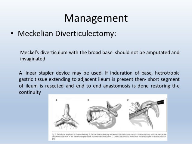 Merkel's diverticulum