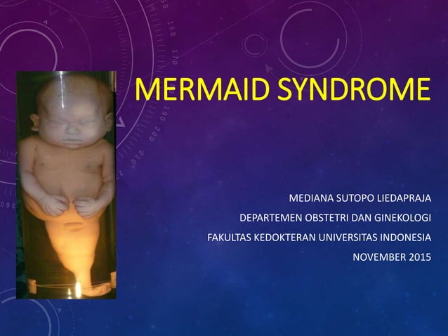 Mermaid syndrome. medi | PPTX