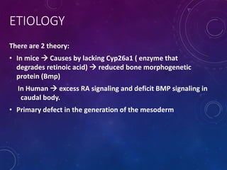 Mermaid syndrome. medi | PPTX
