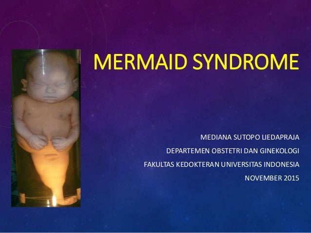 Mermaid syndrome. medi