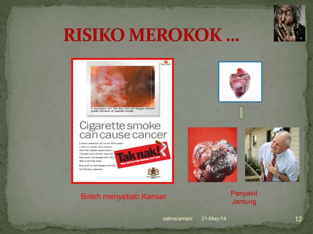 Merokok dan kesihatan oral edit | PPT