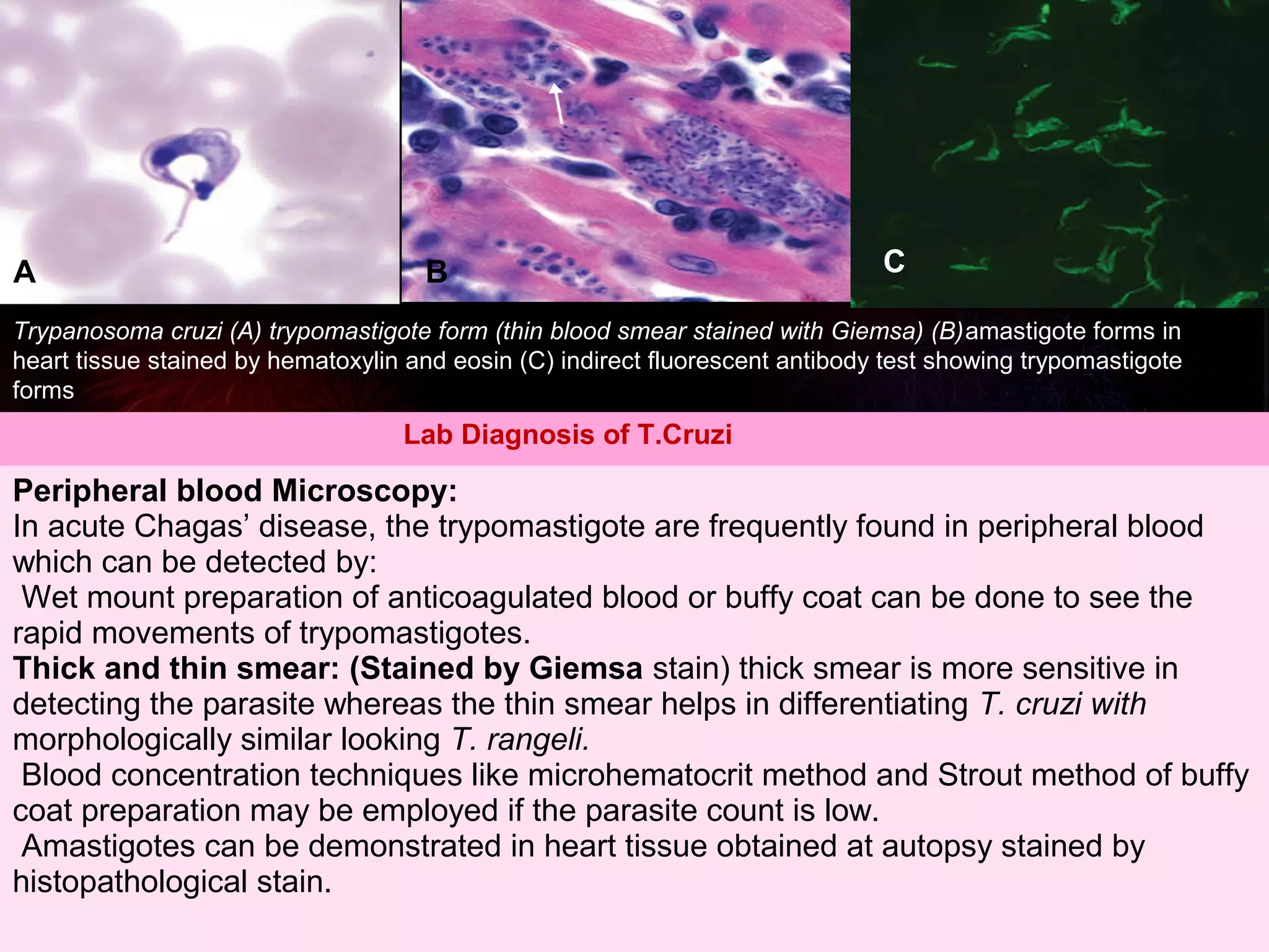 Role of parasites in neoplastic disorders | PPT