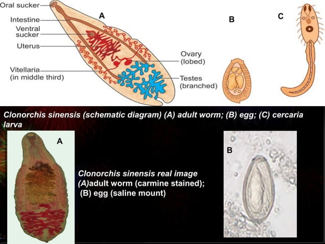 Role of parasites in neoplastic disorders | PPT | Infectious Diseases ...