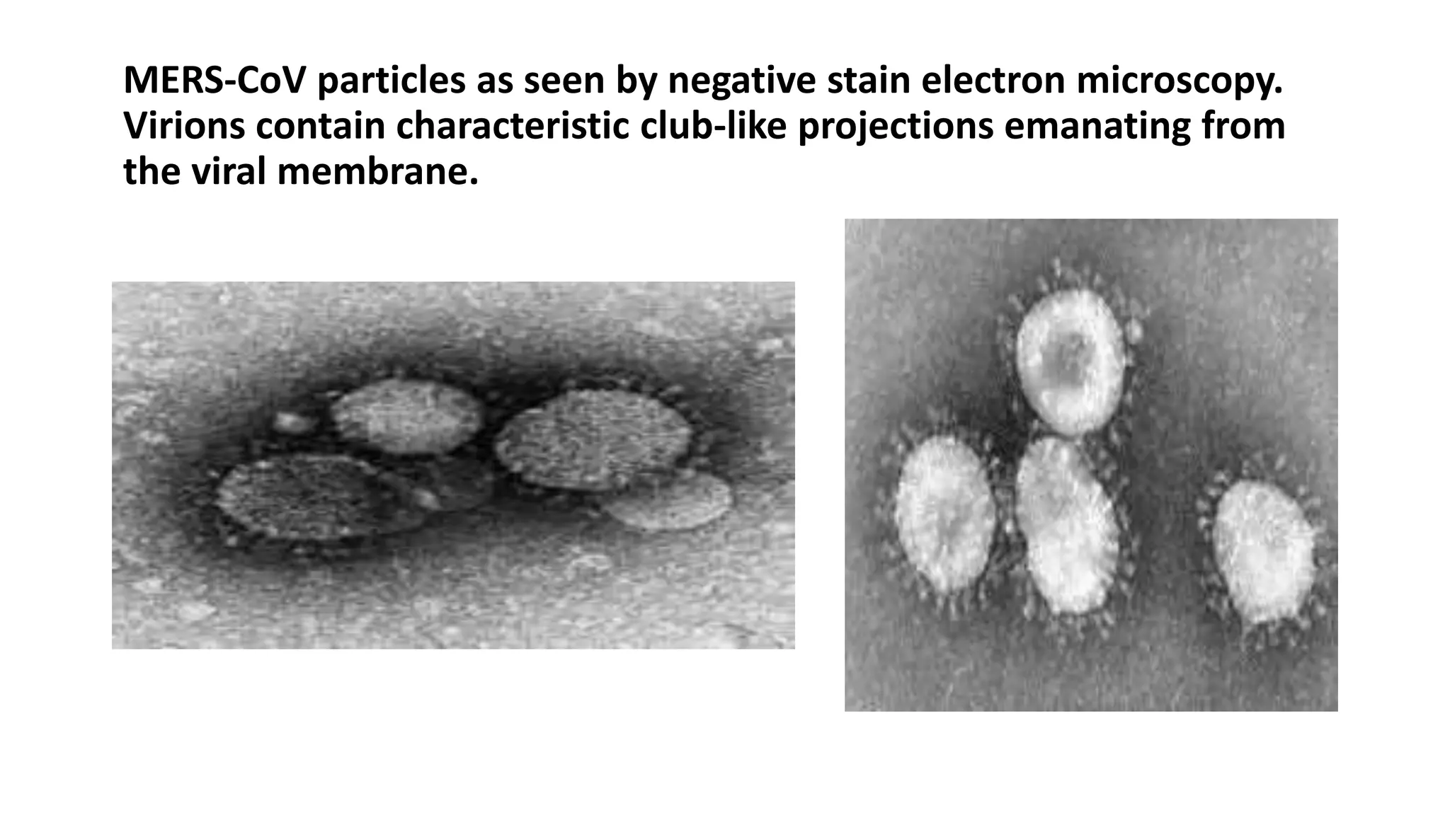 Middle East Respiratory Syndrome: MERS- CoV | PPTX