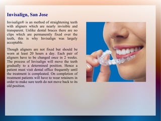 Mervyn Chang DDS, San Jose | PPT