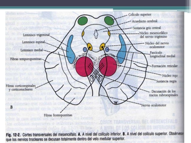 Mesecefalo