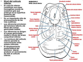 Mesencefalo | PPT