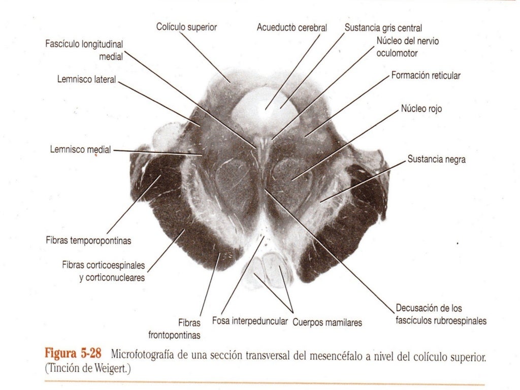 Mesencefalo. Neuroanatomía Clínica del Dr. Richard Snell.