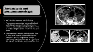 Mesenteric ischemia | PDF