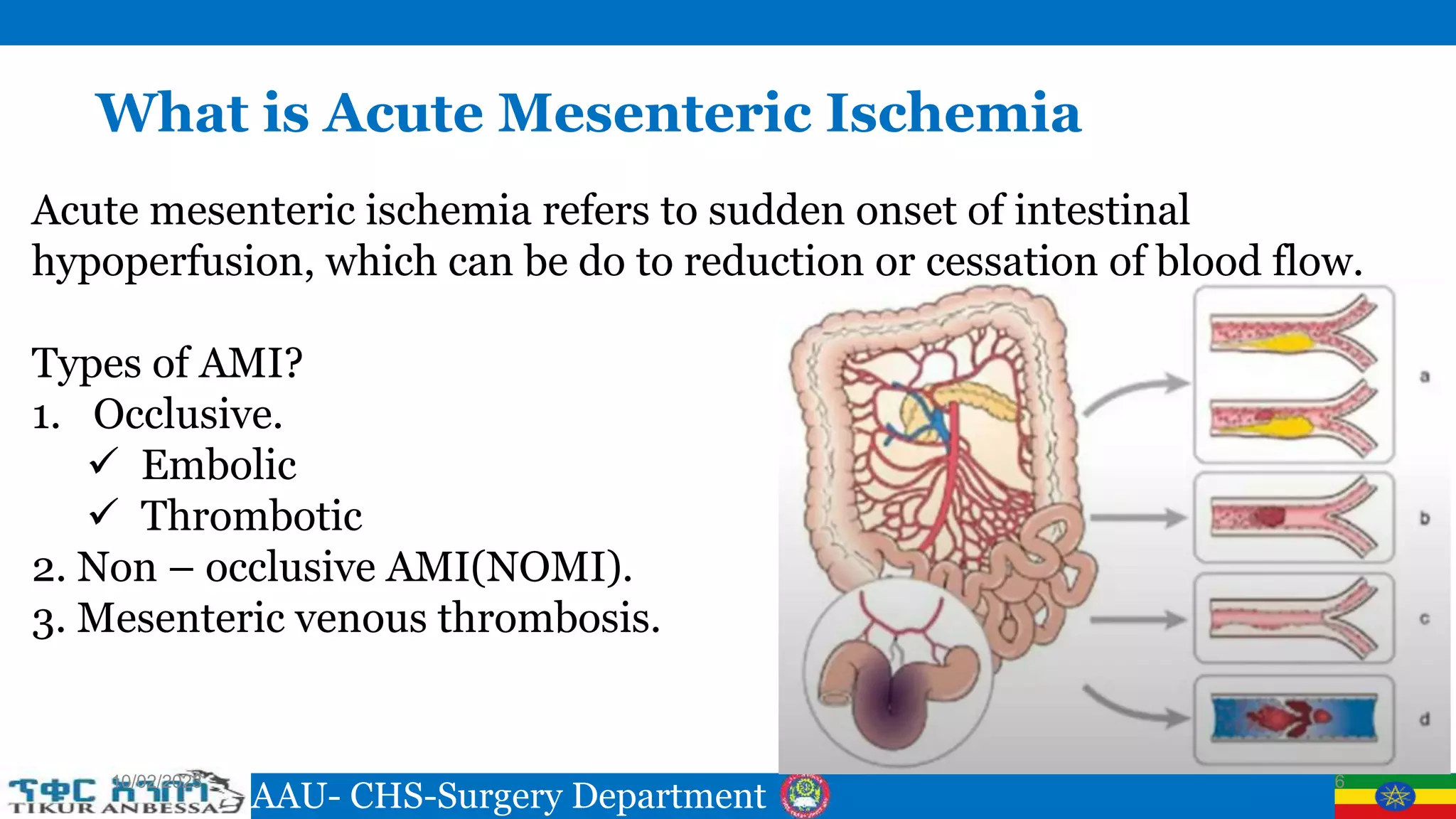 Acute Mesenteric Ischemia.pptx Addis Ababa Uriversity, Ethiopia | PPTX