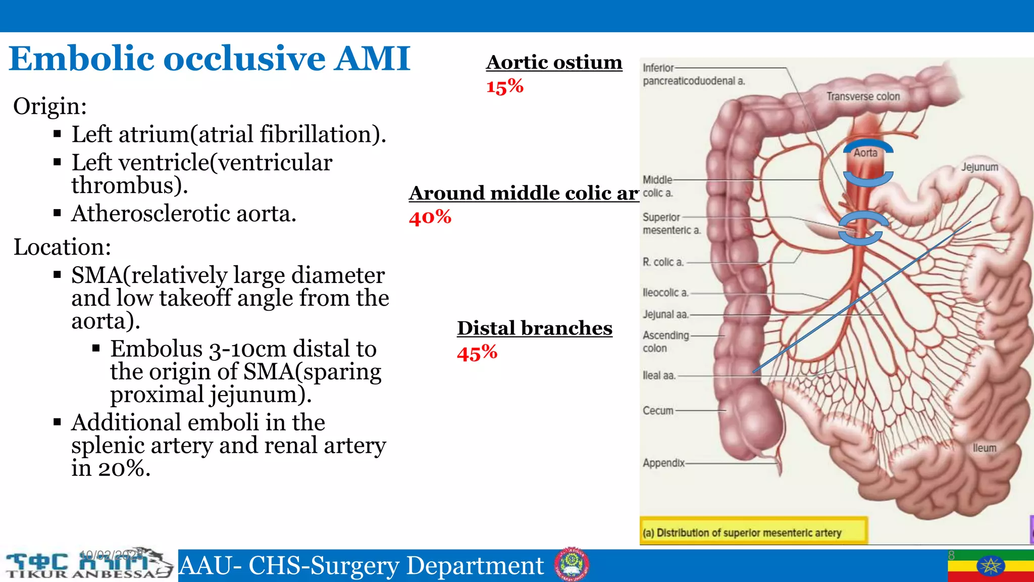 Acute Mesenteric Ischemia.pptx Addis Ababa Uriversity, Ethiopia | PPTX