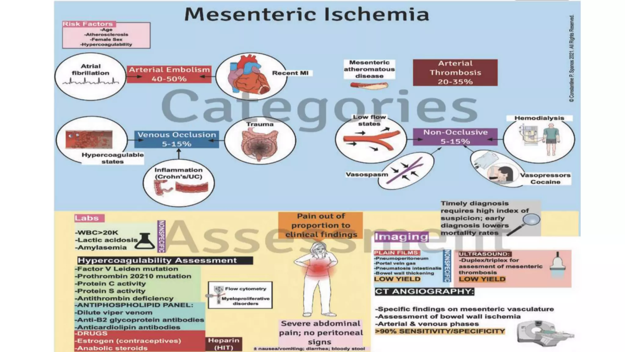 Mesenteric Ischemia Pptx