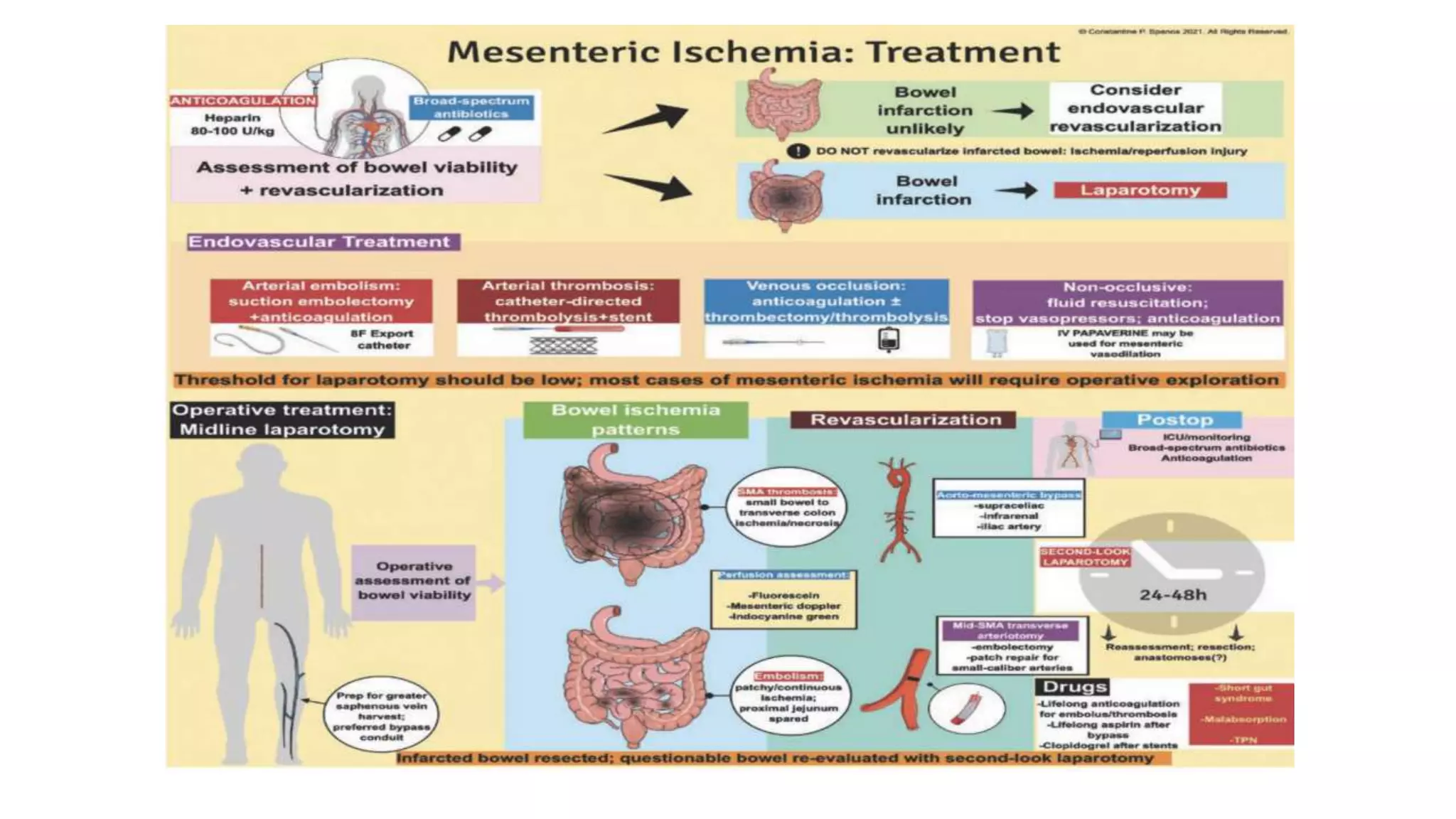 Mesenteric Ischemia | PPTX