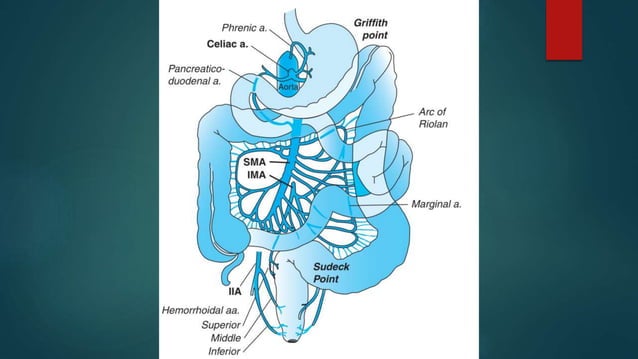 Mesenteric vascular disease | PPTX | Heart and Cardiovascular Diseases ...
