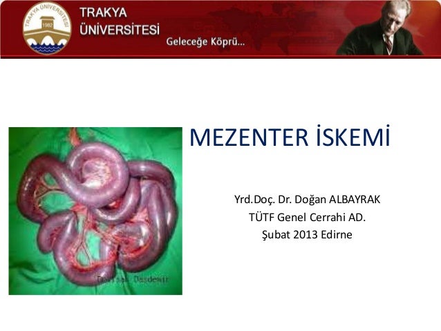 Mesenter iskemi