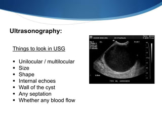 Mesenteric cyst - Journal club | PPTX