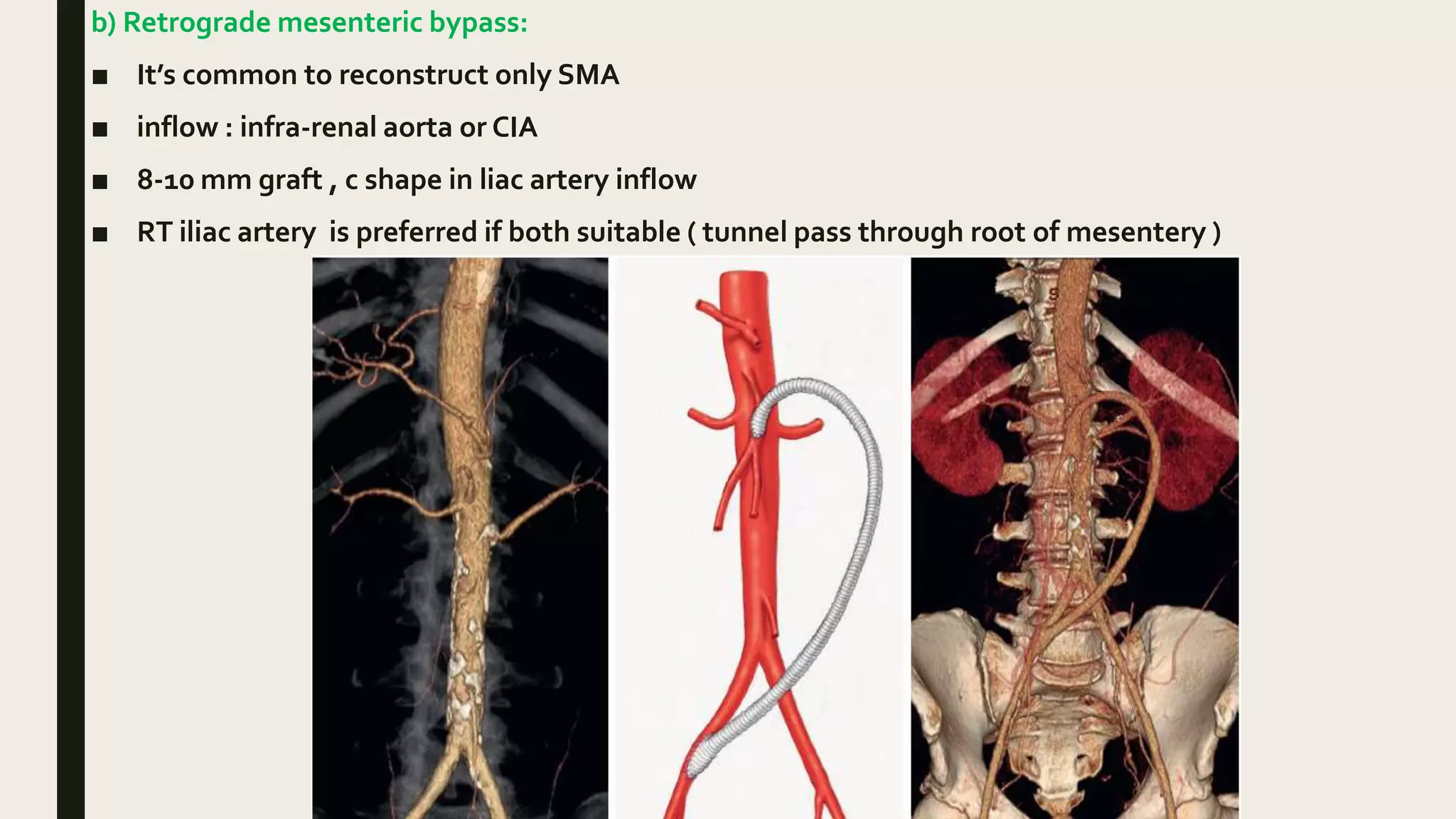 Mesenteric diseases | PPTX