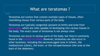 Causes Of Teratoma Tumors – What Is A Teratoma – NRTC