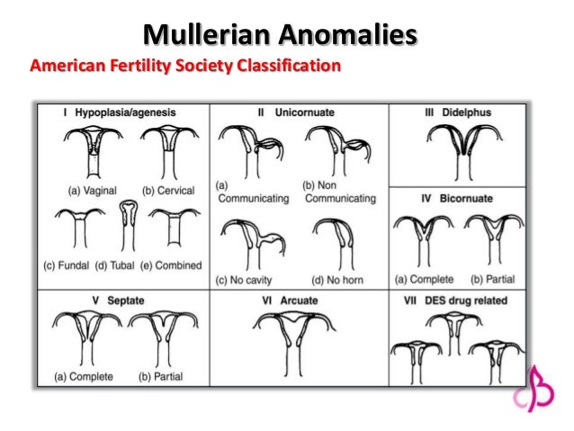 Surgical Management of Uterine Abnormality