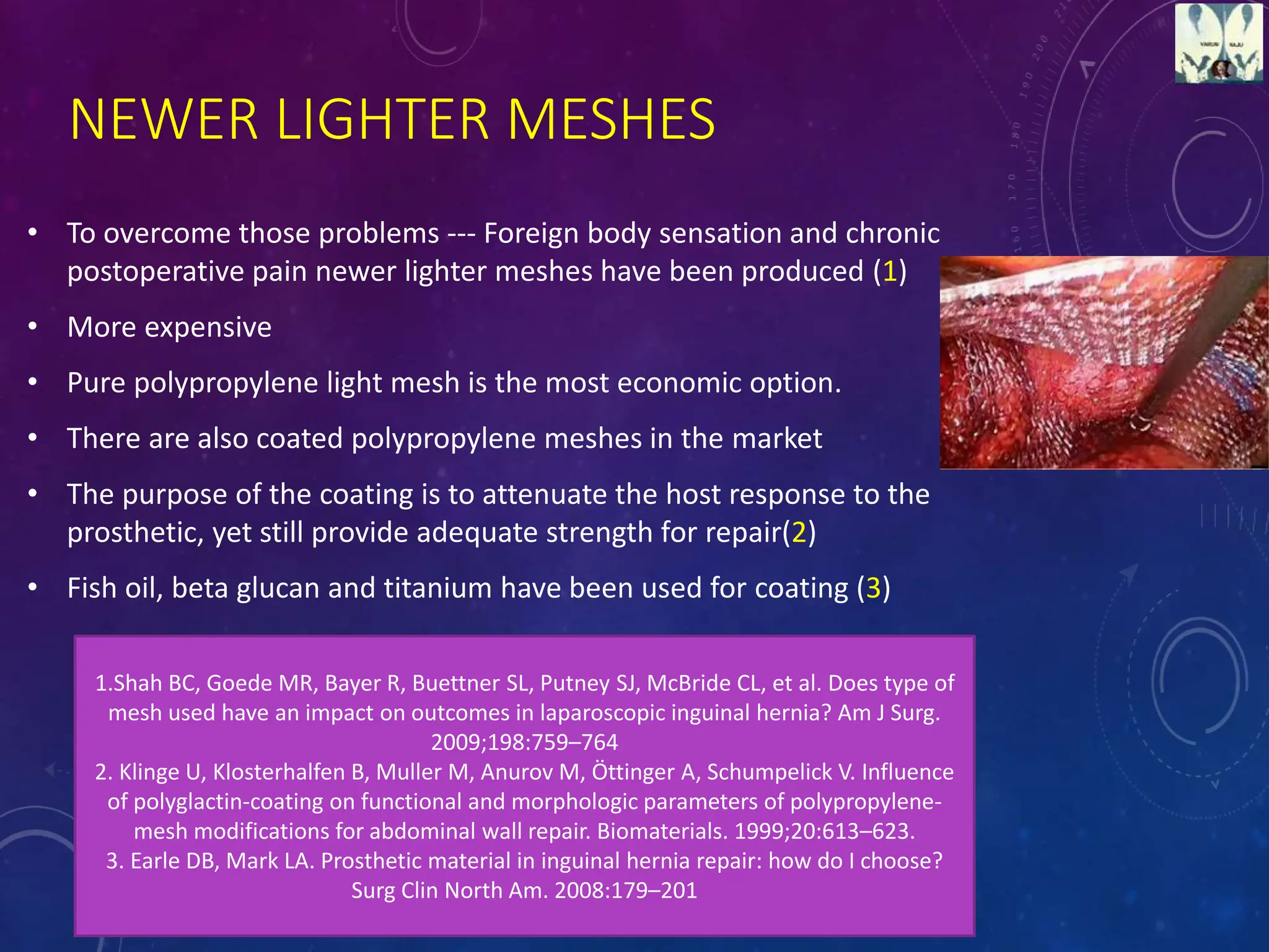 MESHES AND METHODS OF FIXATION.pptx