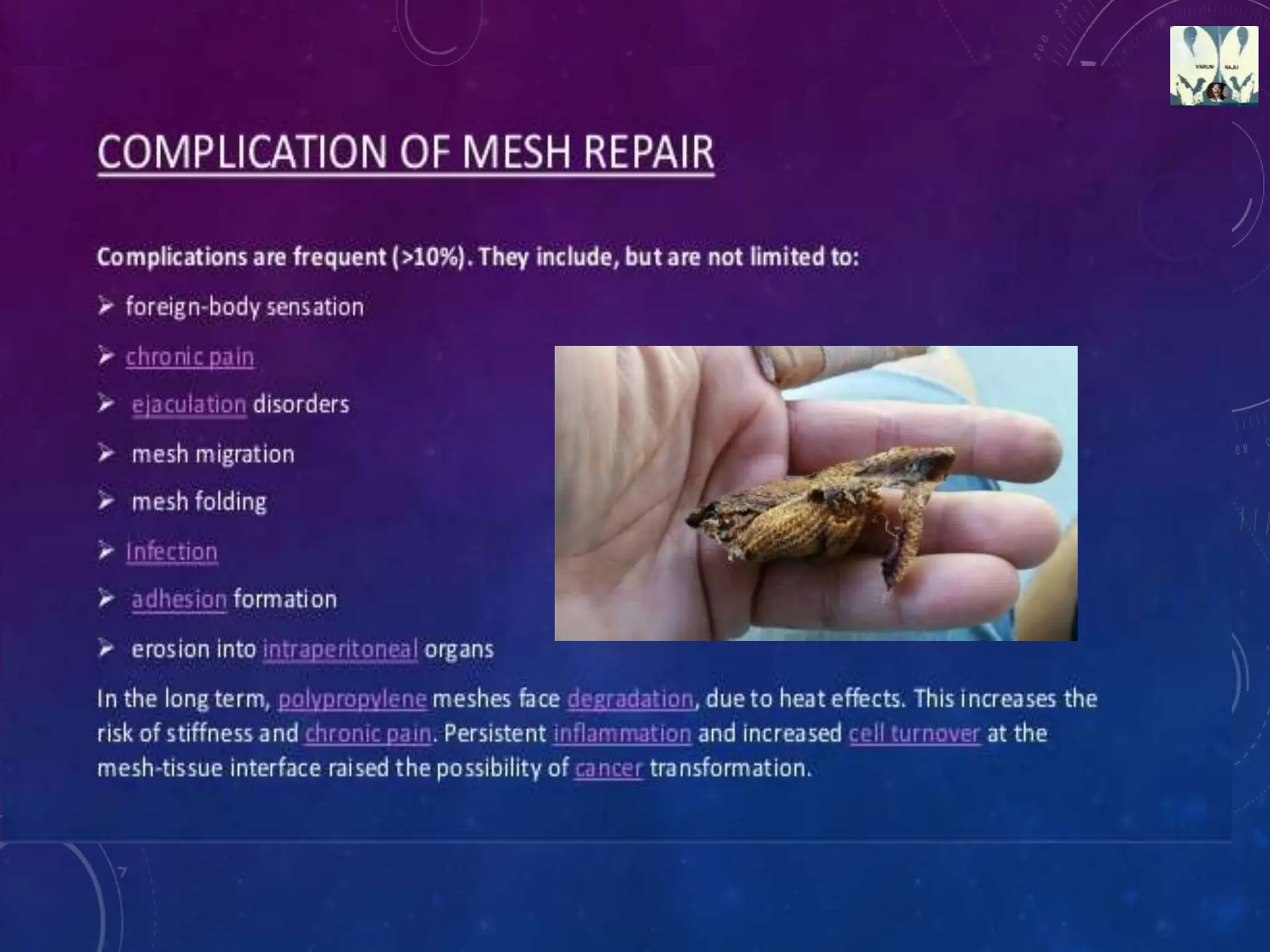 MESHES AND METHODS OF FIXATION.pptx