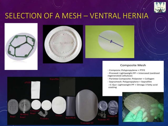 MESHES AND METHODS OF FIXATION.pptx