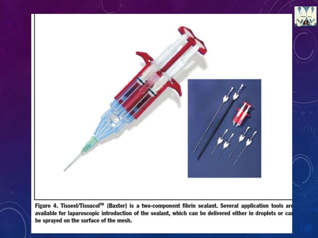 MESHES AND METHODS OF FIXATION.pptx