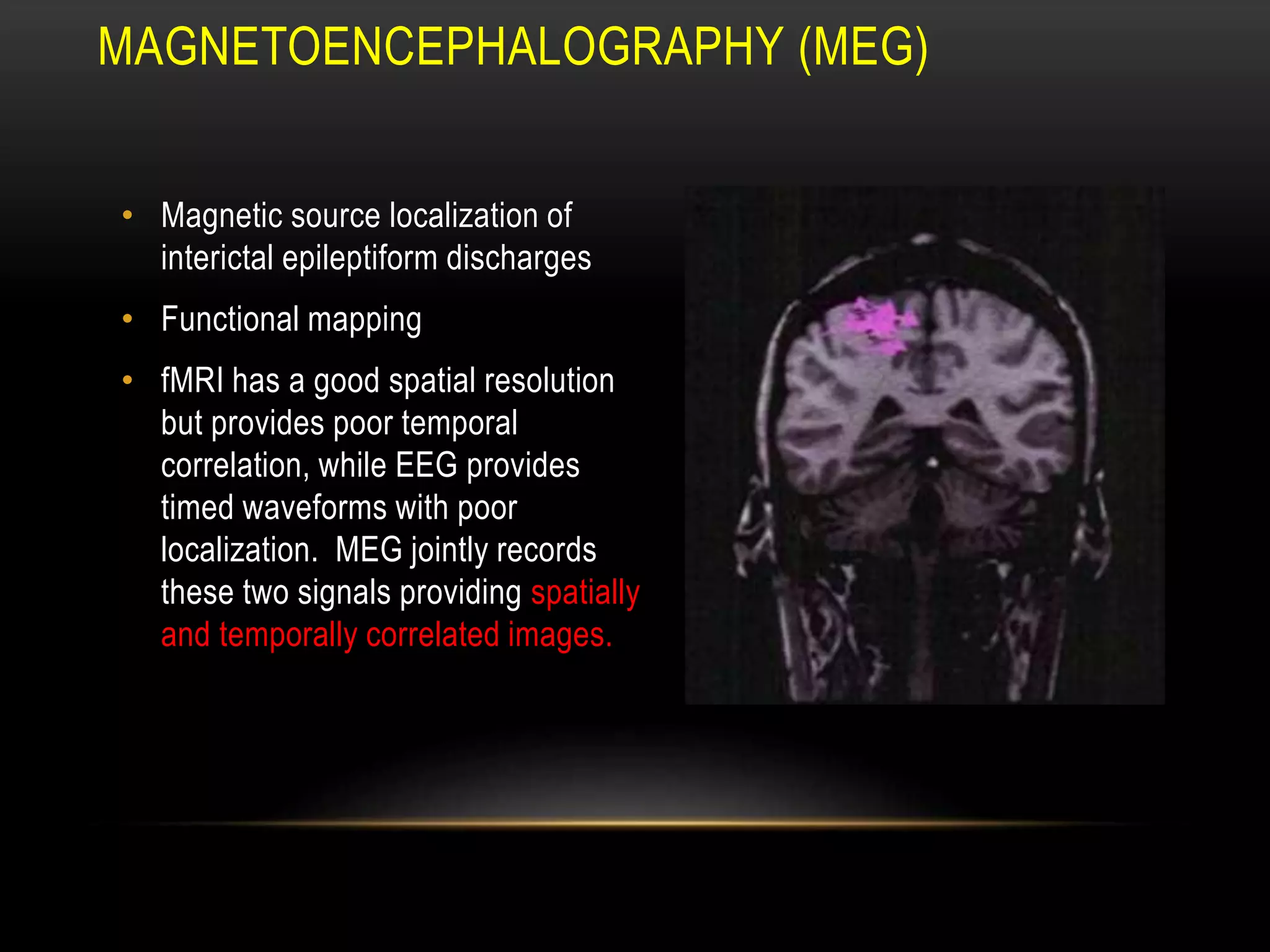 Mesial temporal lobe epilepsy | PPTX