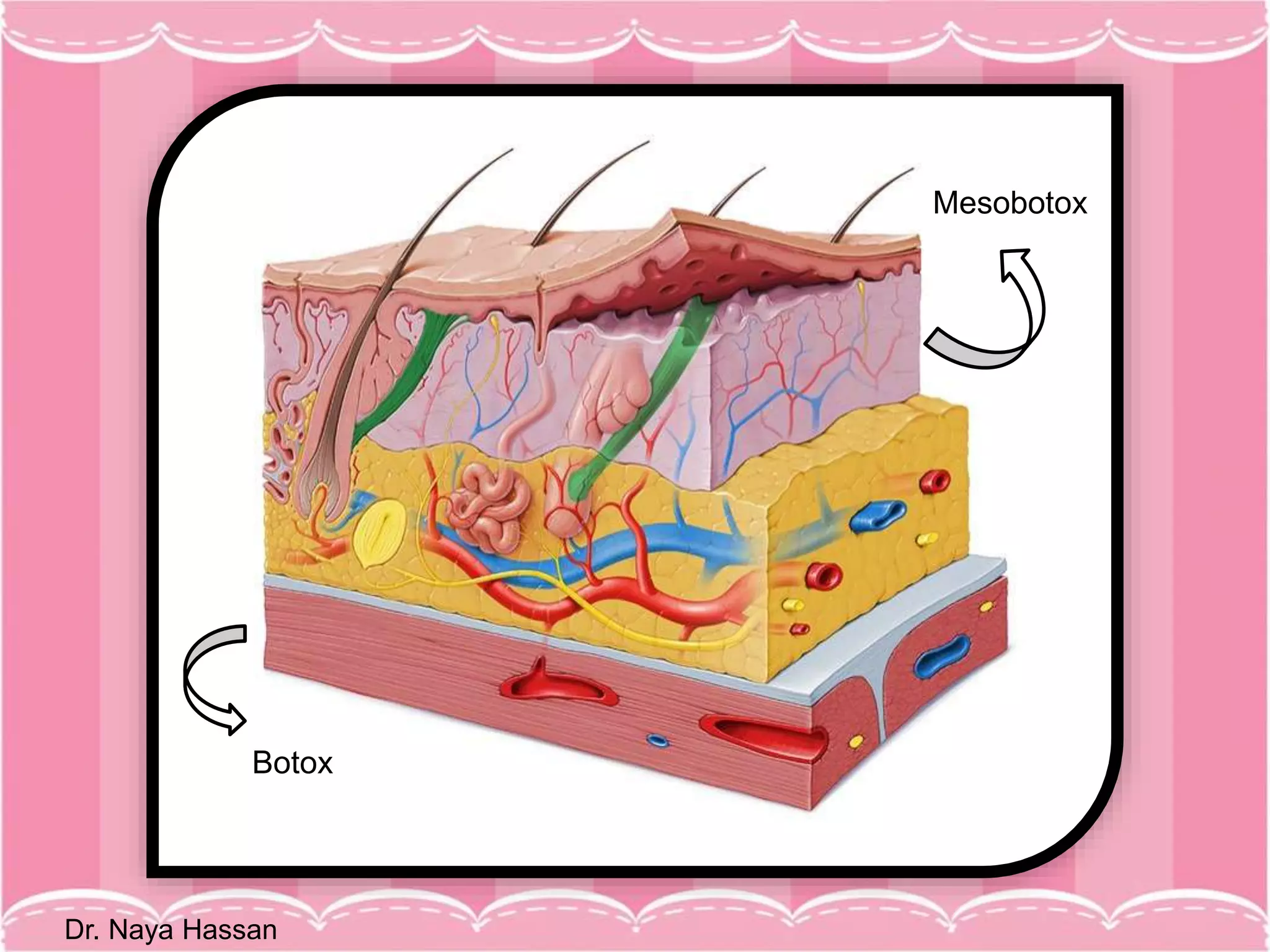 Mesobotox: a New Technique for Aesthetic Treatments | PPTX