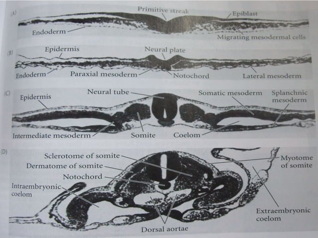 Mesoderm | PPT | Heart and Cardiovascular Diseases | Diseases and ...