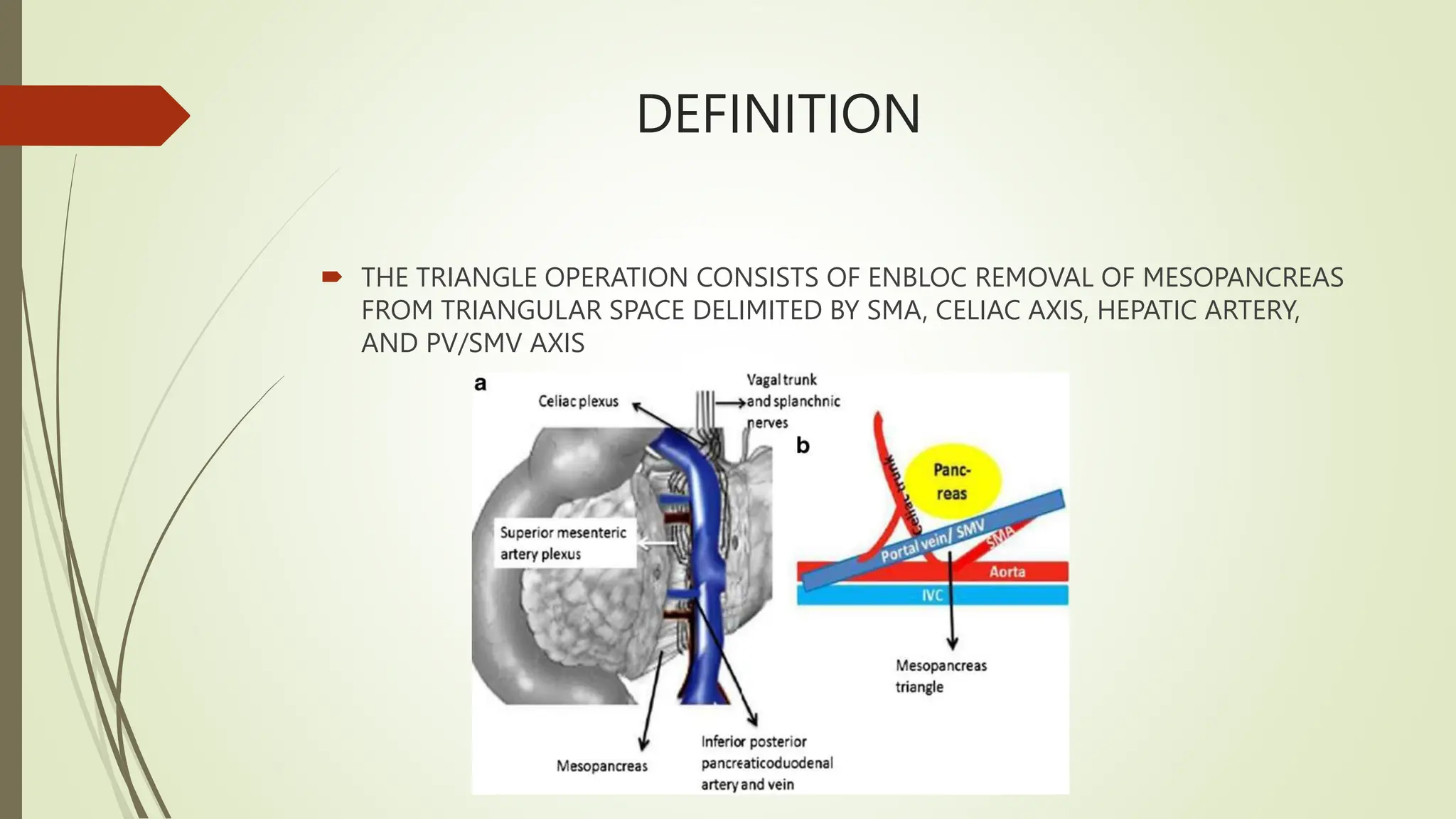 Management of MESOPANCREAS& TRIANGLE OPERATION.pptx