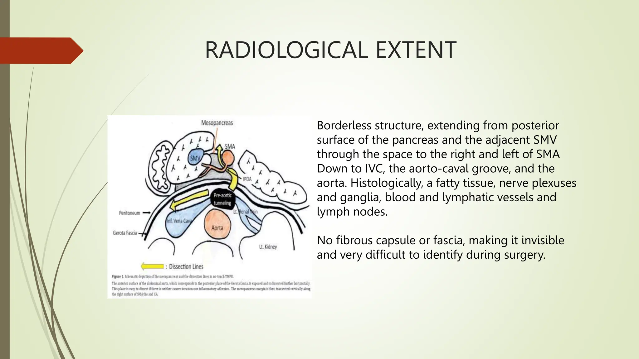Management of MESOPANCREAS& TRIANGLE OPERATION.pptx